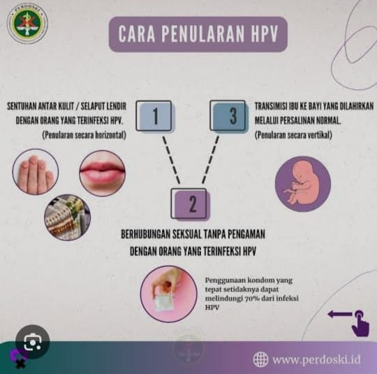 Virus HPV?? Ayo lawan dengan Vaksin HPV !! – Alo Gaes